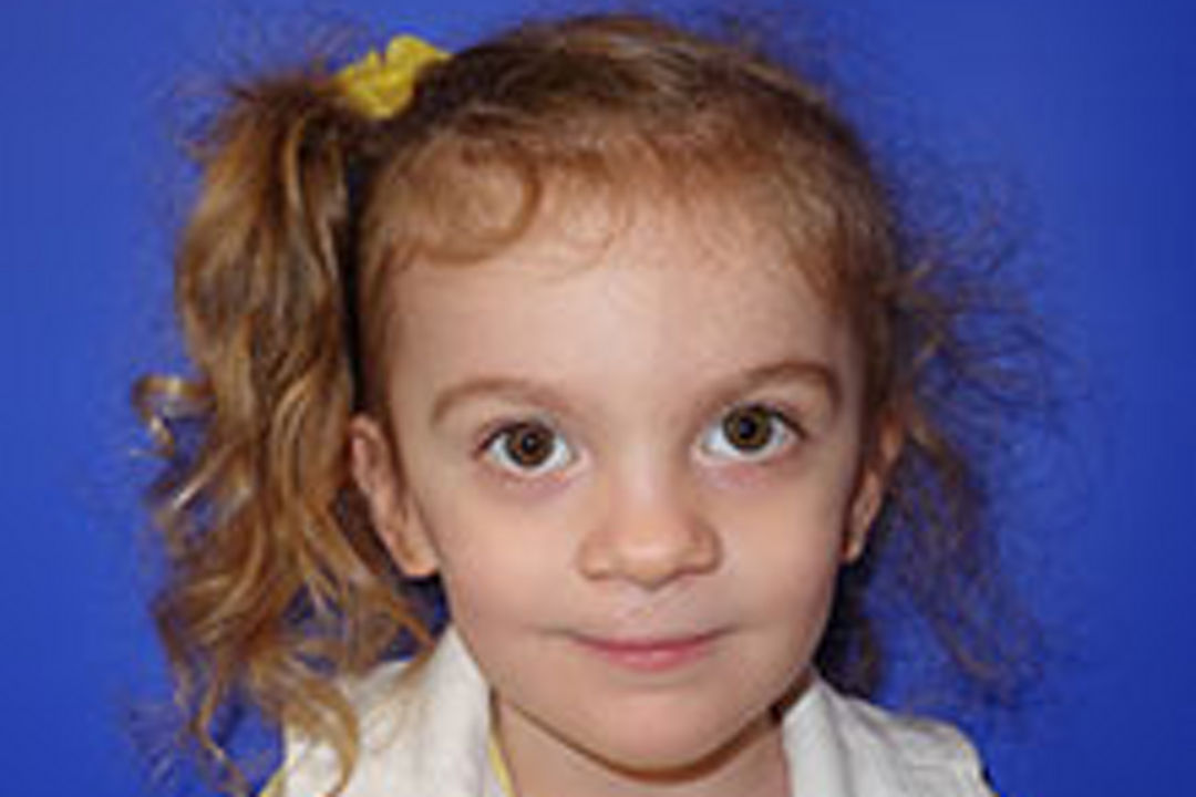 What to Expect at Your Initial Cleft and Craniofacial Team Visit ...