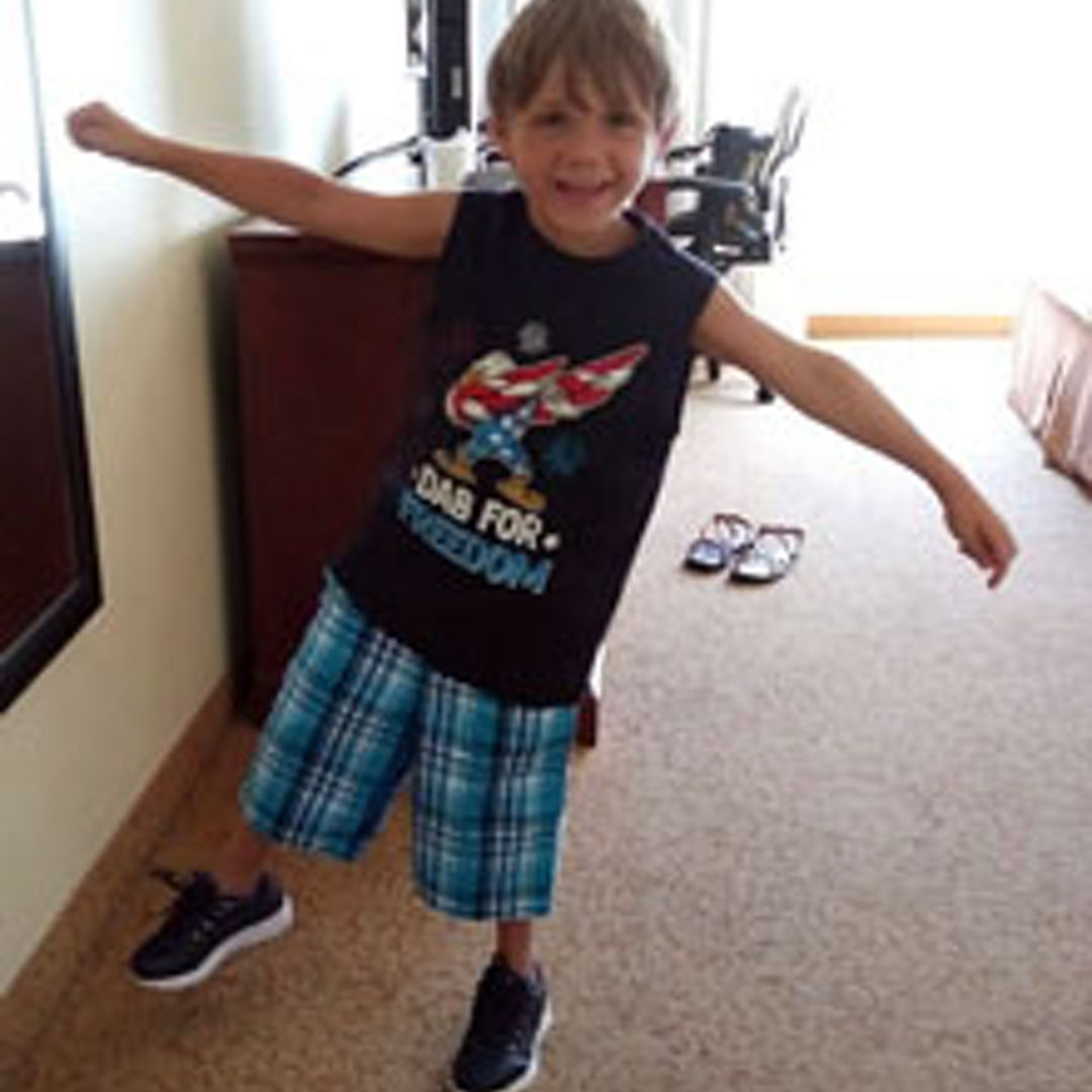 Clubfoot Program - Stanford Medicine Children's Health